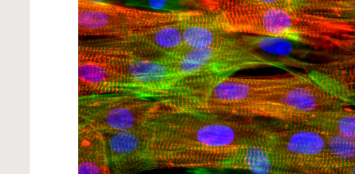 Bioengineering | Harvard John A. Paulson School of Engineering and ...