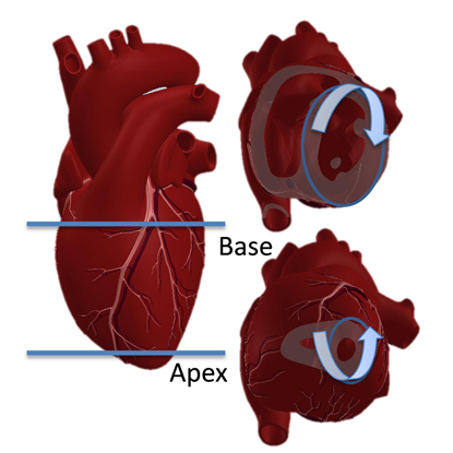 Artificial muscles do the twist | Harvard John A. Paulson School of ...